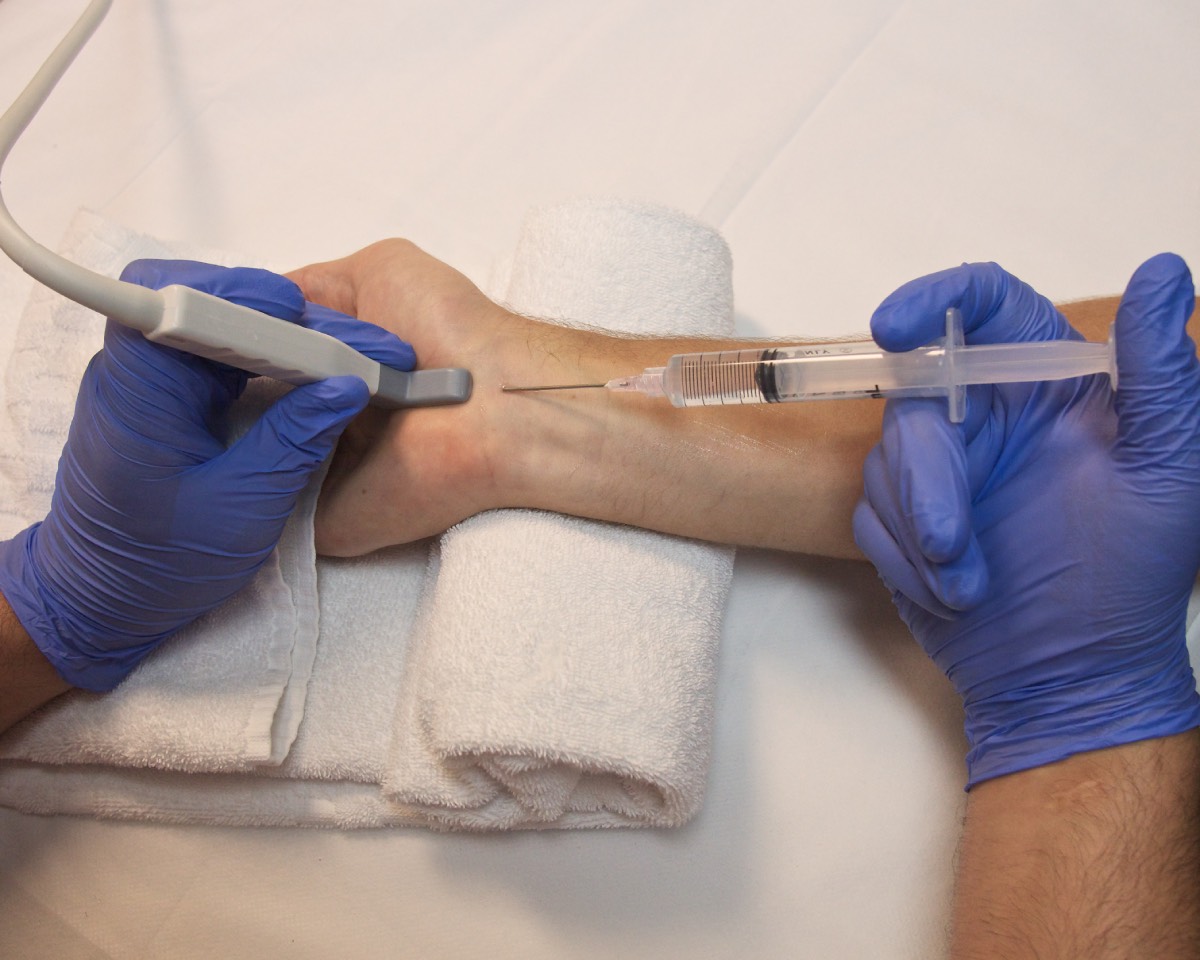 Deep Tissue Peripheral Nerve Block - Kansas Anesthesia Associates